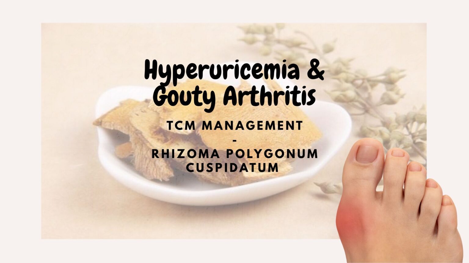 The usage of TCM and western medicine in the treatment of hyperuricemia ...
